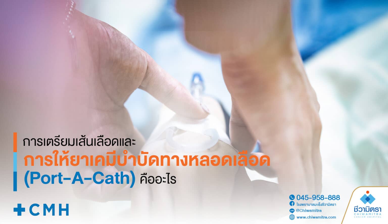 Port A Cath คืออะไร วิธีเตรียมตัวก่อนให้เคมีบำบัดทางพอร์ต